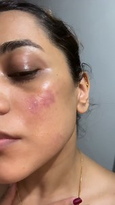 821K views · 1.9K reactions | We did it ❤️ 1,000 faces, 1,000 stories, 1,000 transformations  What began as self-healing turned into a movement of glow, strength, and belief. Thank you to everyone who trusted my hands and heart 懶 Here’s to more lifted faces and lifted souls! #FaceYogaByParvathy #1000FacesStrong #GlowFromWithin . . . . . . . #reels #reel #instagram #insta #faceyogabyparvathy #parvathykrishnafaceyoga | Parvathy R Krishna | Facebook