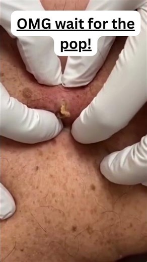 OMG wait for the pop!